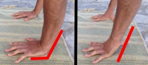 Dealing with Wrist Sprains - Antranik.org